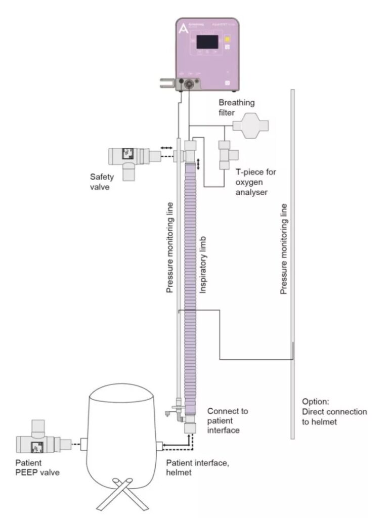 FD140-Breathing-Circuit-Setup-CPAP-Helmet | Eakin Respiratory