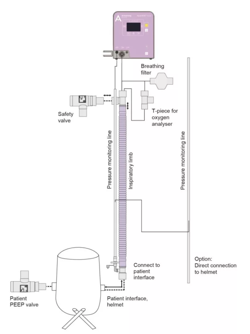 FD140-Breathing-Circuit-Setup-CPAP-Helmet | Eakin Respiratory