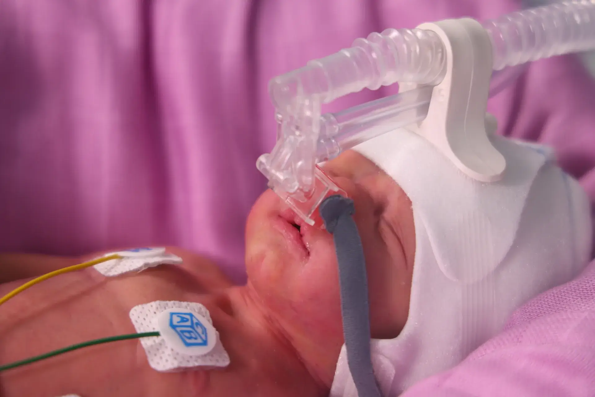 1N5A9855 | Eakin Respiratory